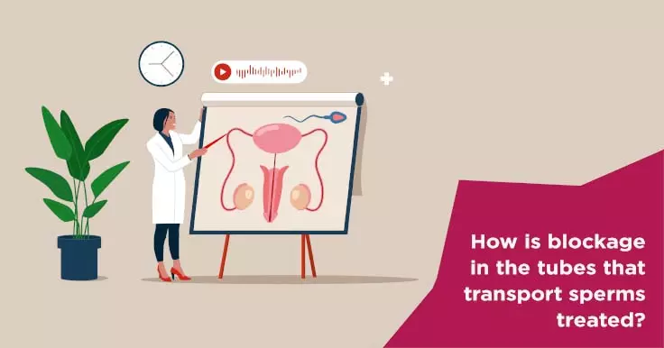 Sperm Blockage Treatment: Solutions for Improved Fertility | Nova IVF ...