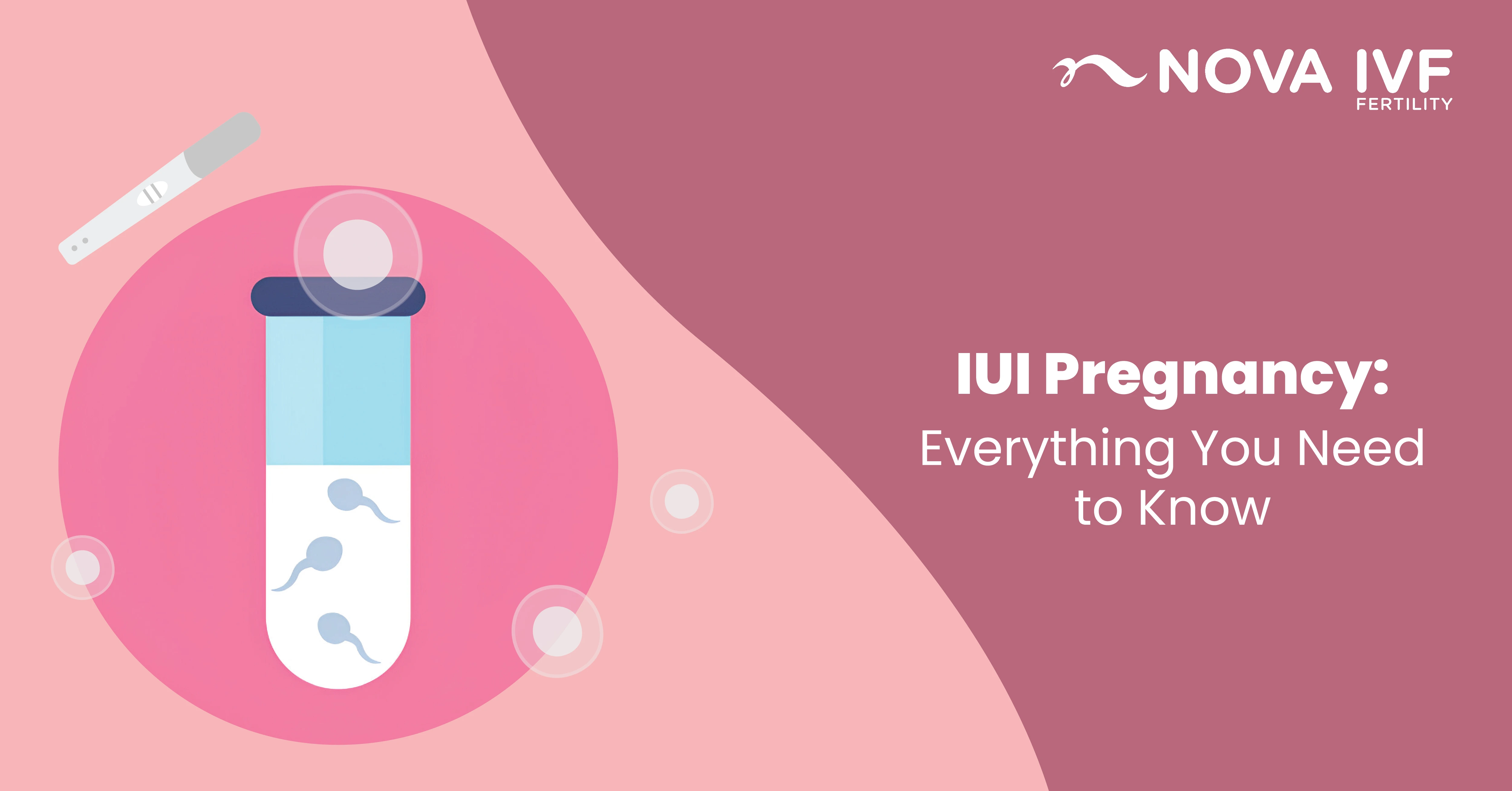 What is IUI Pregnancy? Insemination Process, Treatment, and Cost